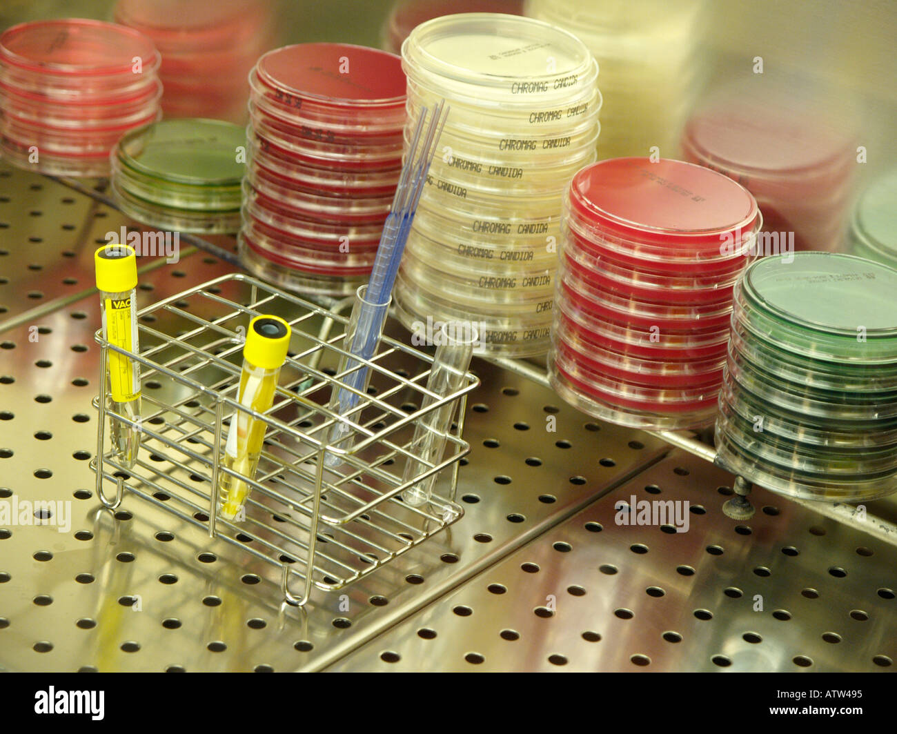 Test in hospital Stock Photo - Alamy
