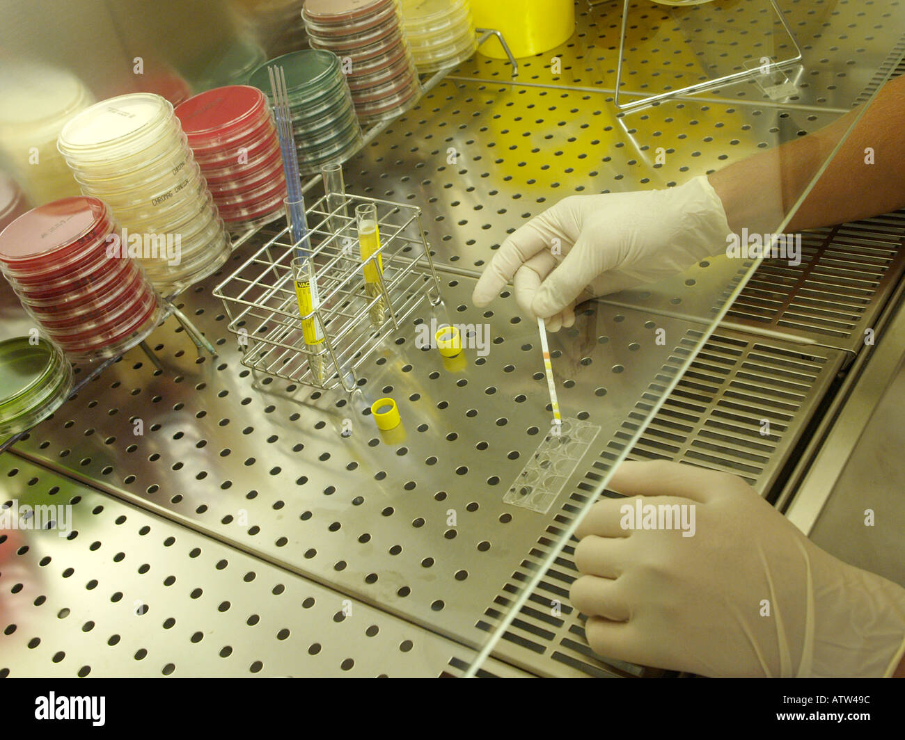 Test in Hospital Stock Photo - Alamy