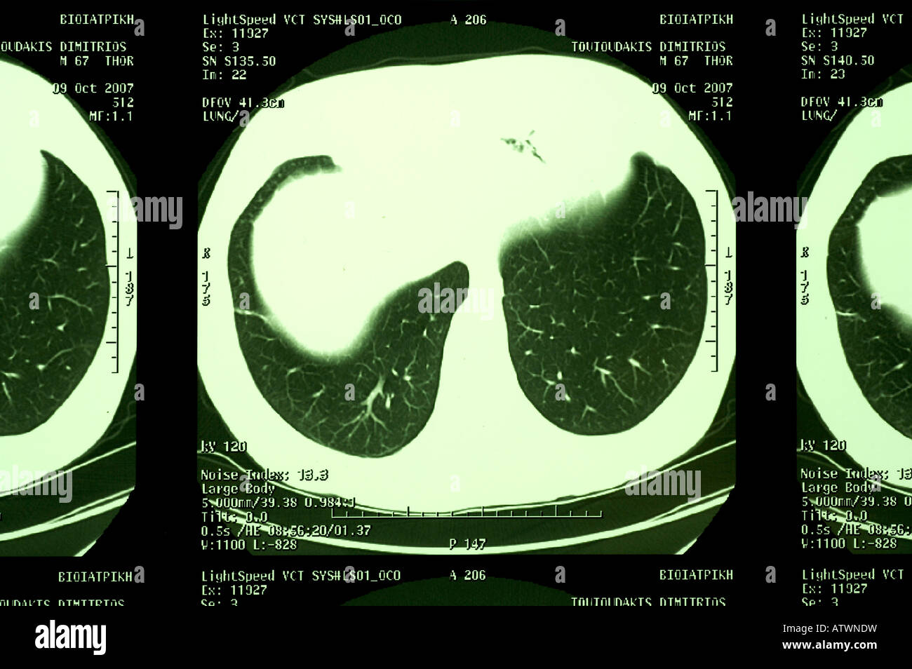 Diagnosis med01157 hi-res stock photography and images - Alamy