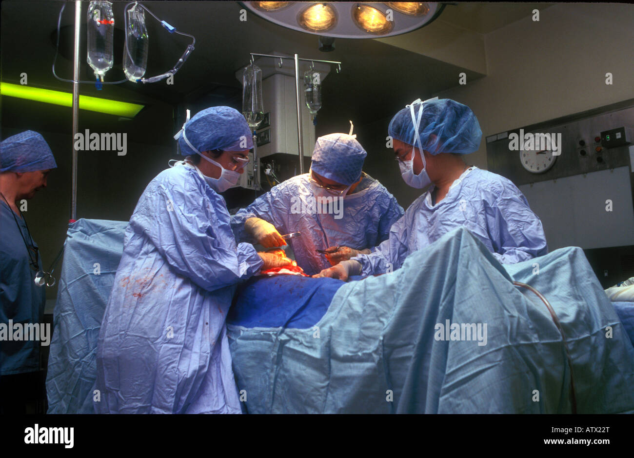 Caesarian operation Stock Photo - Alamy