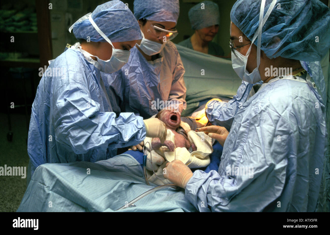 Caesarean nhs hi-res stock photography and images - Alamy