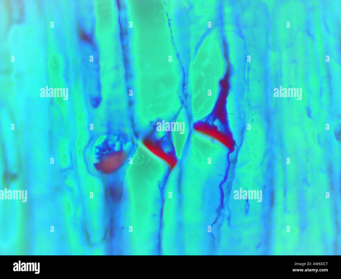 Xylem tissue hi-res stock photography and images - Alamy