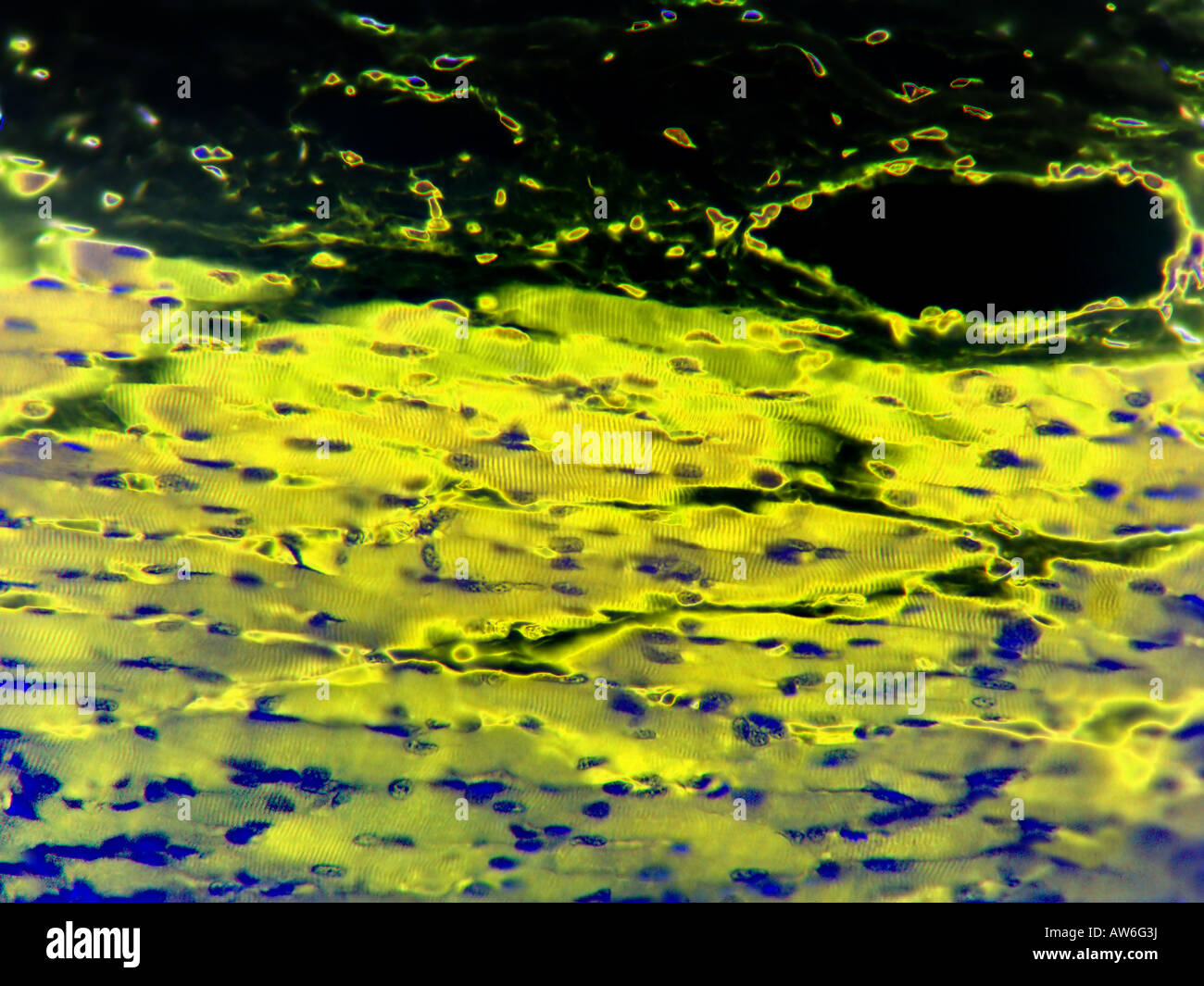 Striated muscle tissue hi-res stock photography and images - Alamy