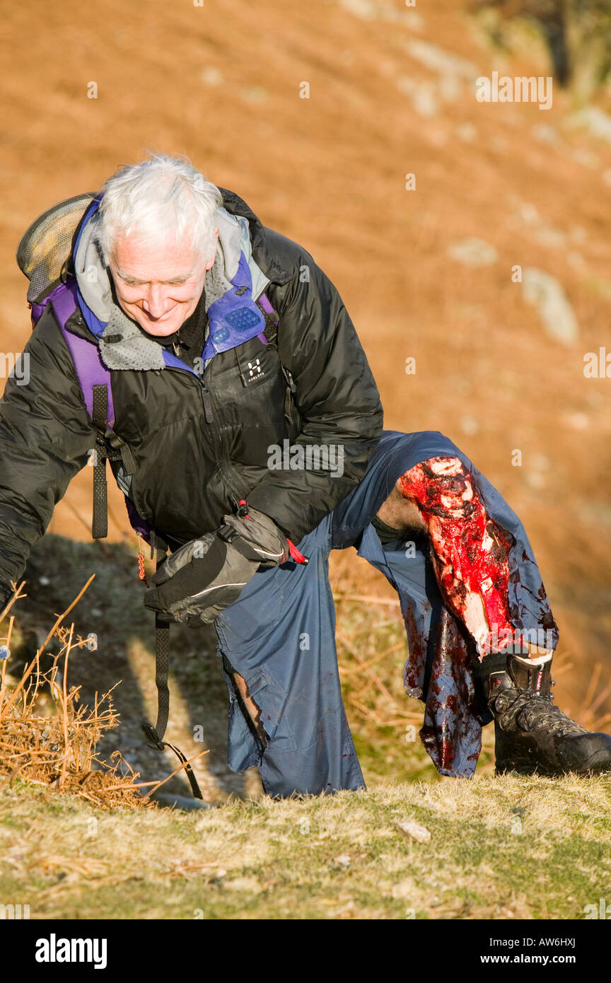 A member of Causalties Union made up to recreate a badly broken leg ...