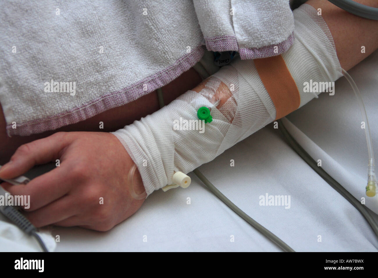 Iv Fluids Stock Photos & Iv Fluids Stock Images - Alamy