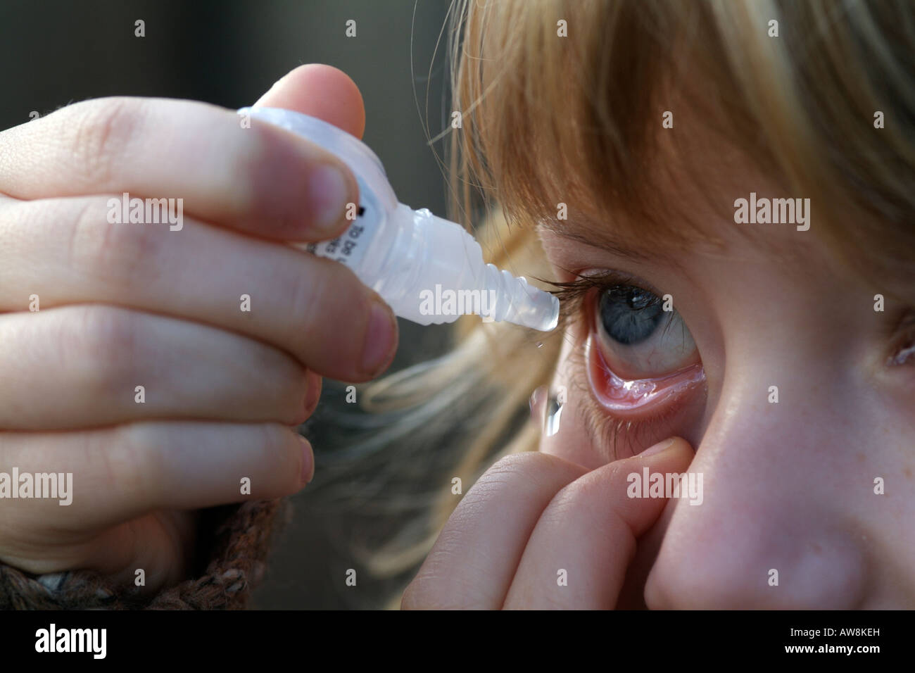 Child Applying Eye Drops Stock Photo - Alamy