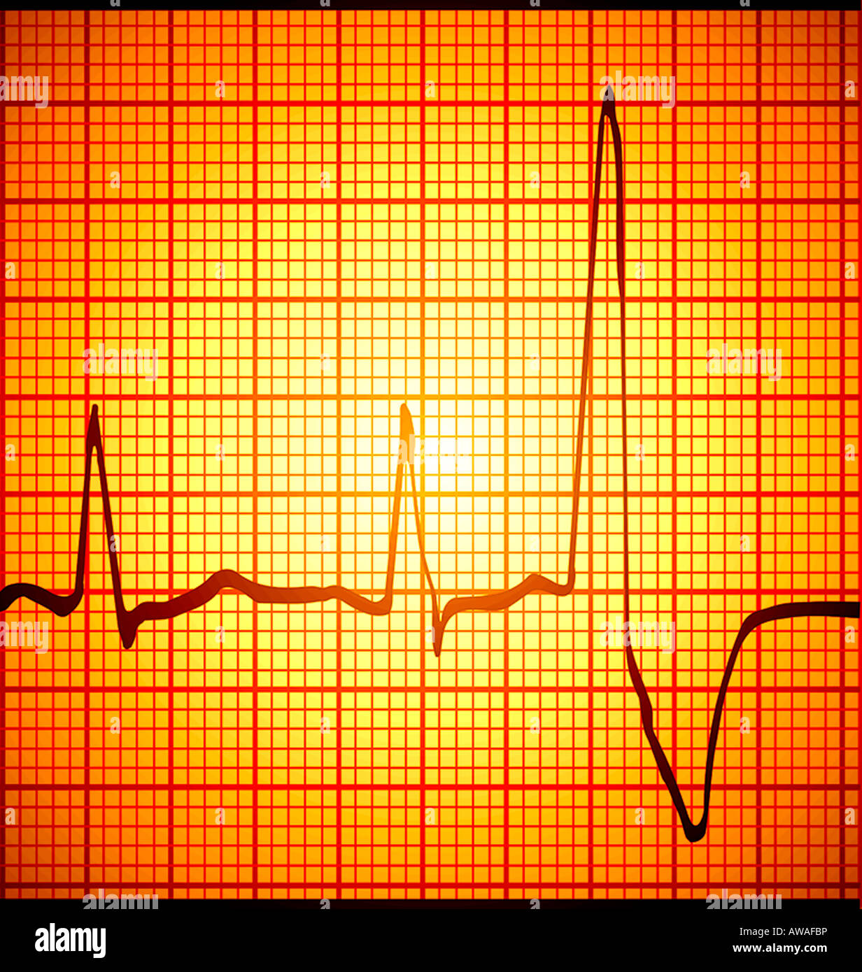 electrocardiogram heartbeat on grid printout Stock Photo - Alamy