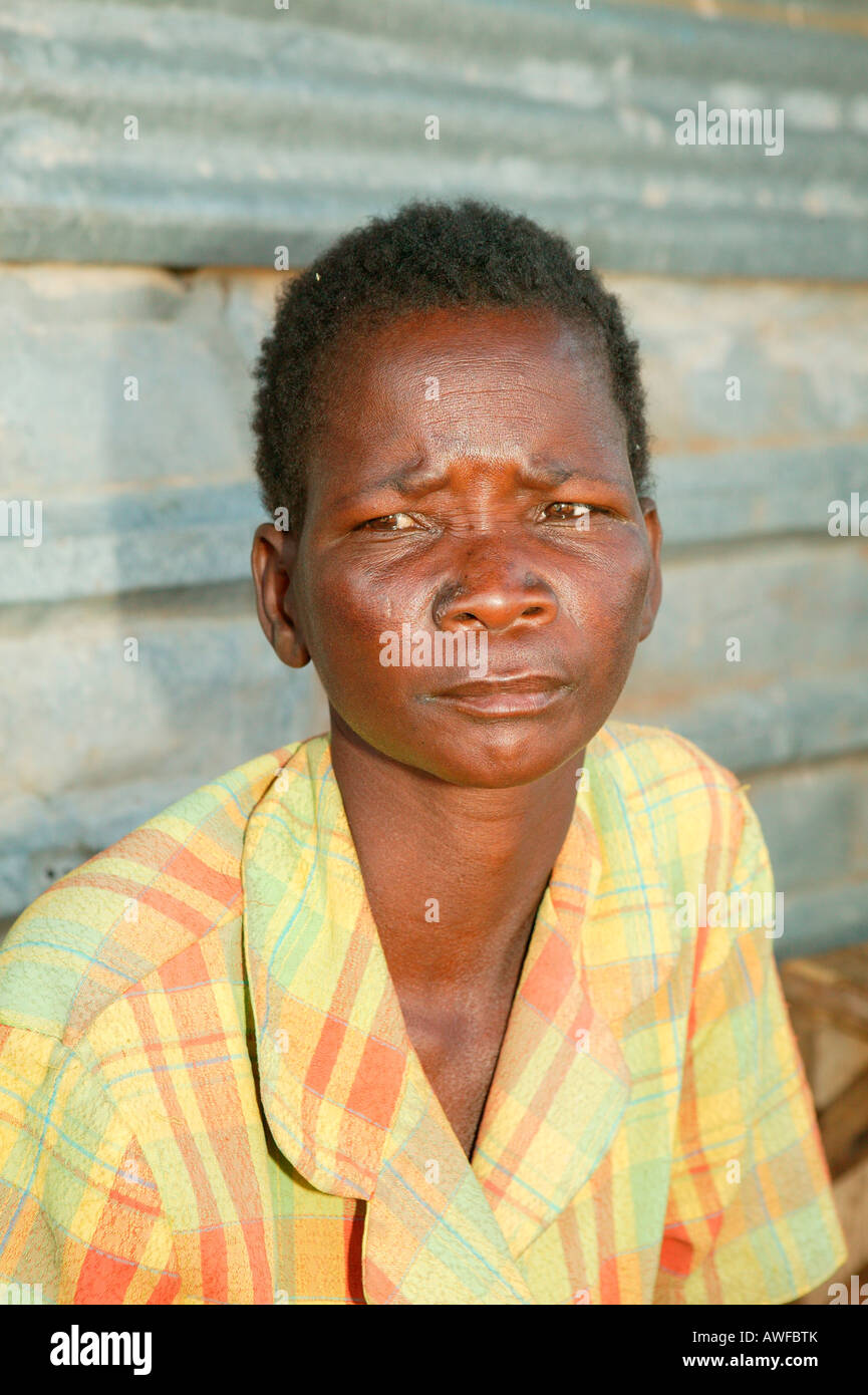 Woman infected with HIV/AIDS, Francistown, Botswana, Africa Stock Photo ...