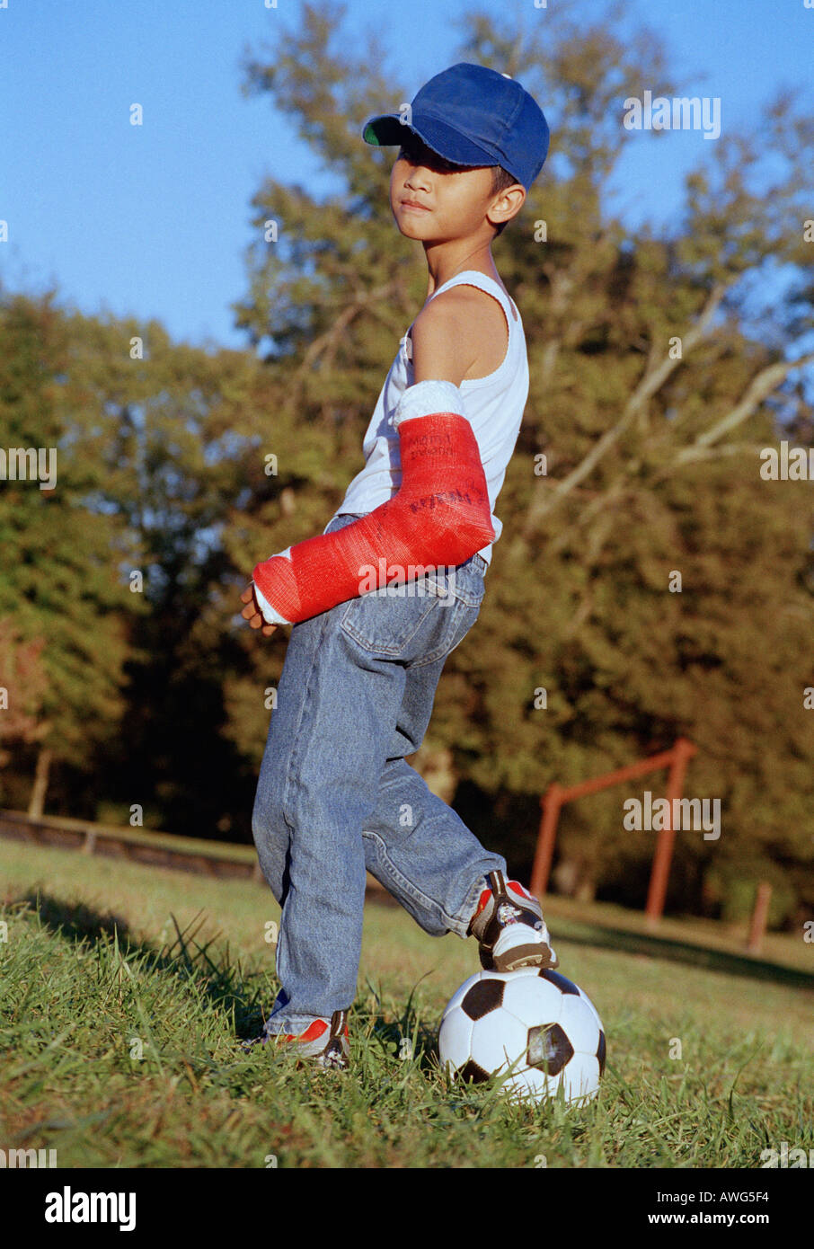 Broken Arm In Football