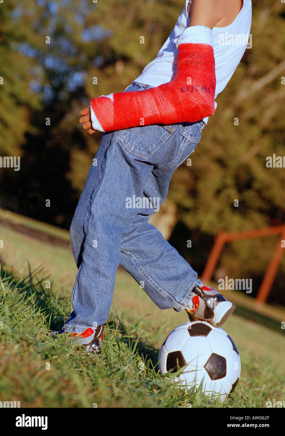 Asian boy with broken arm who wants to play soccer Stock Photo - Alamy