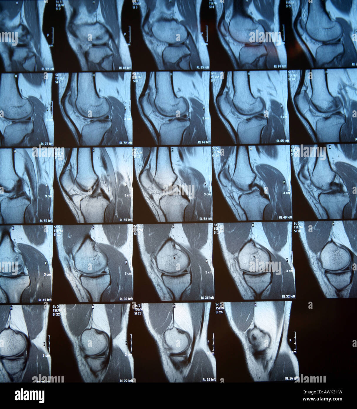 X ray pattern hi-res stock photography and images - Alamy