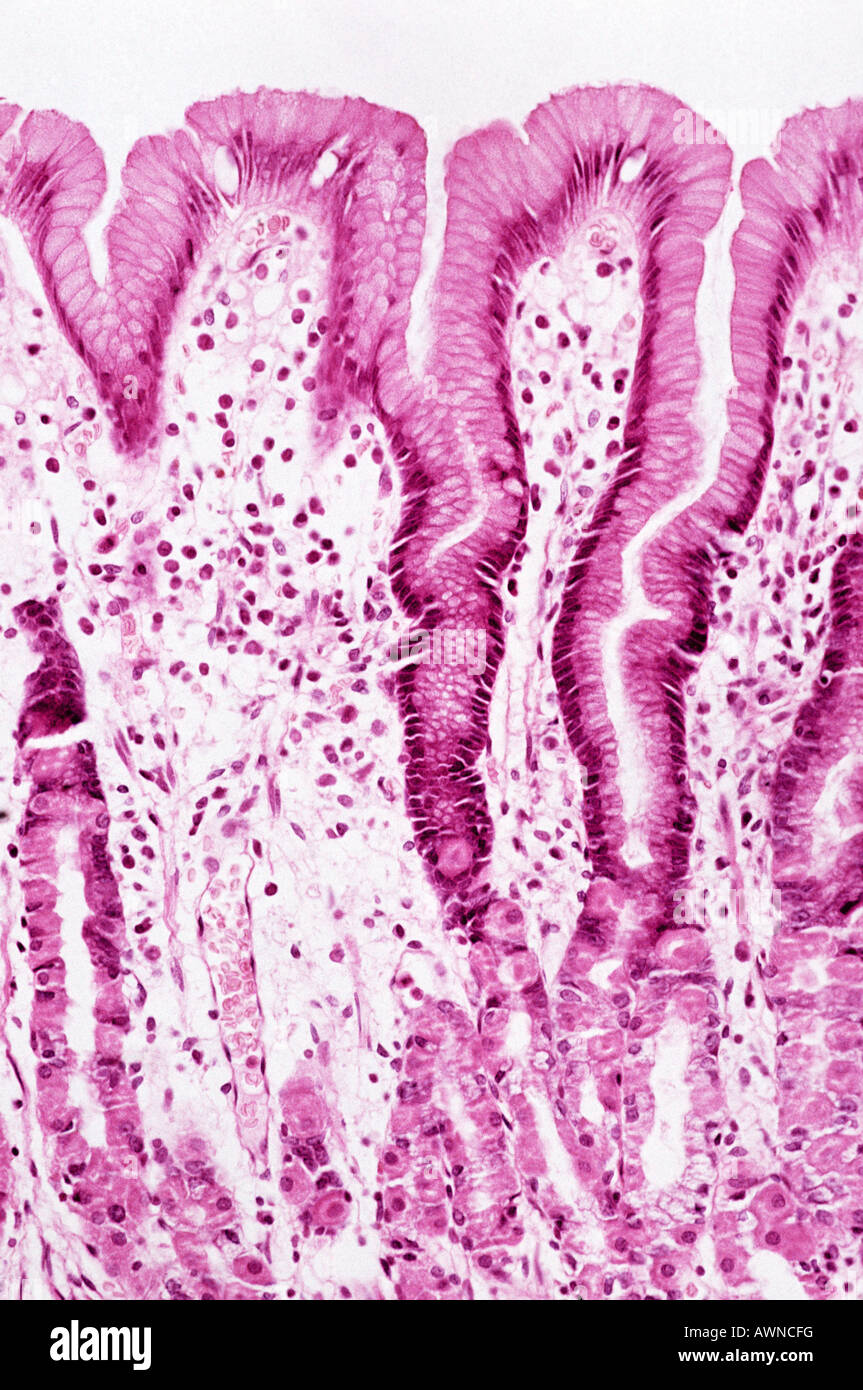 Human Stomach High Resolution Stock Photography and Images - Alamy