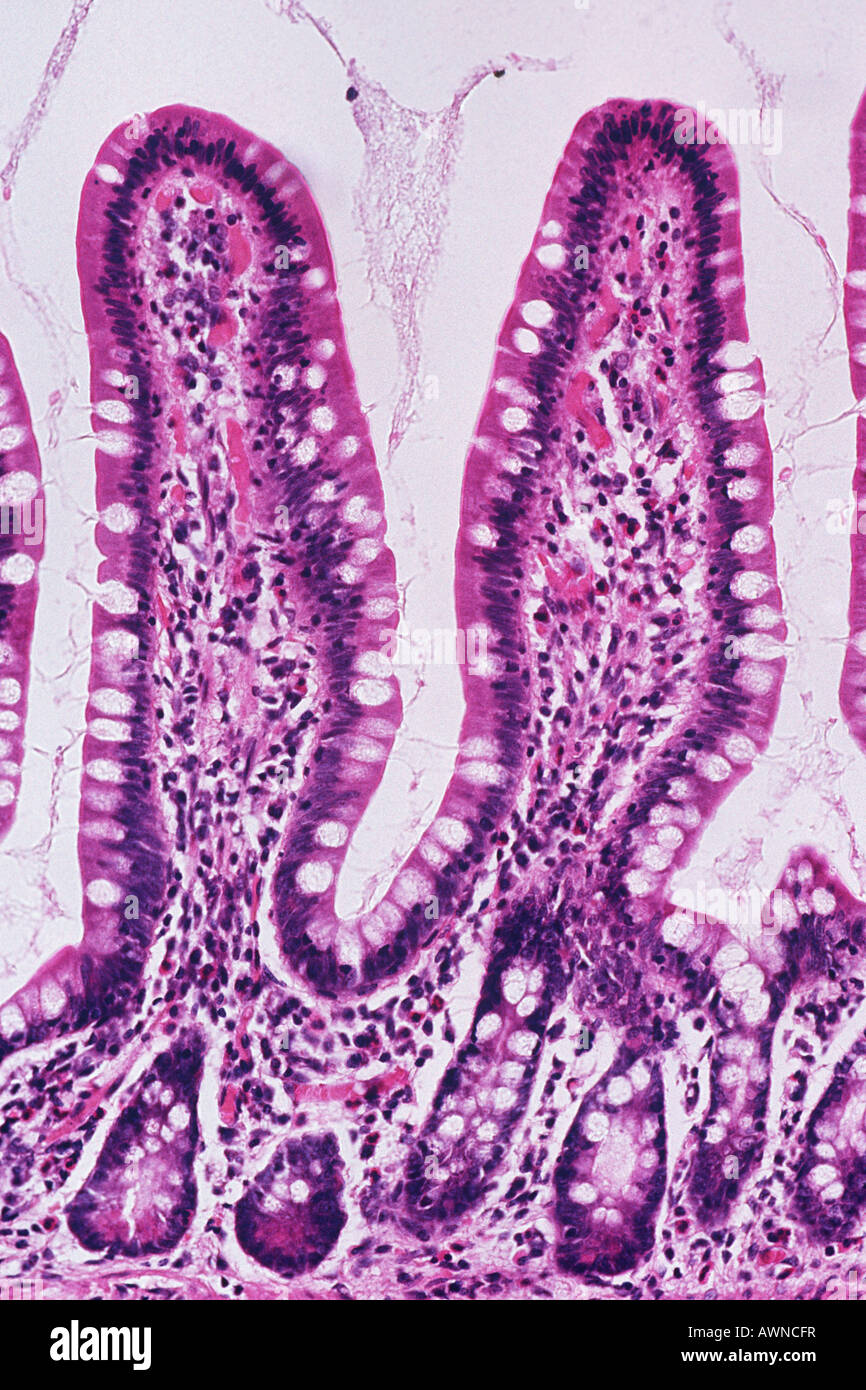 Ileum Histology Drawing