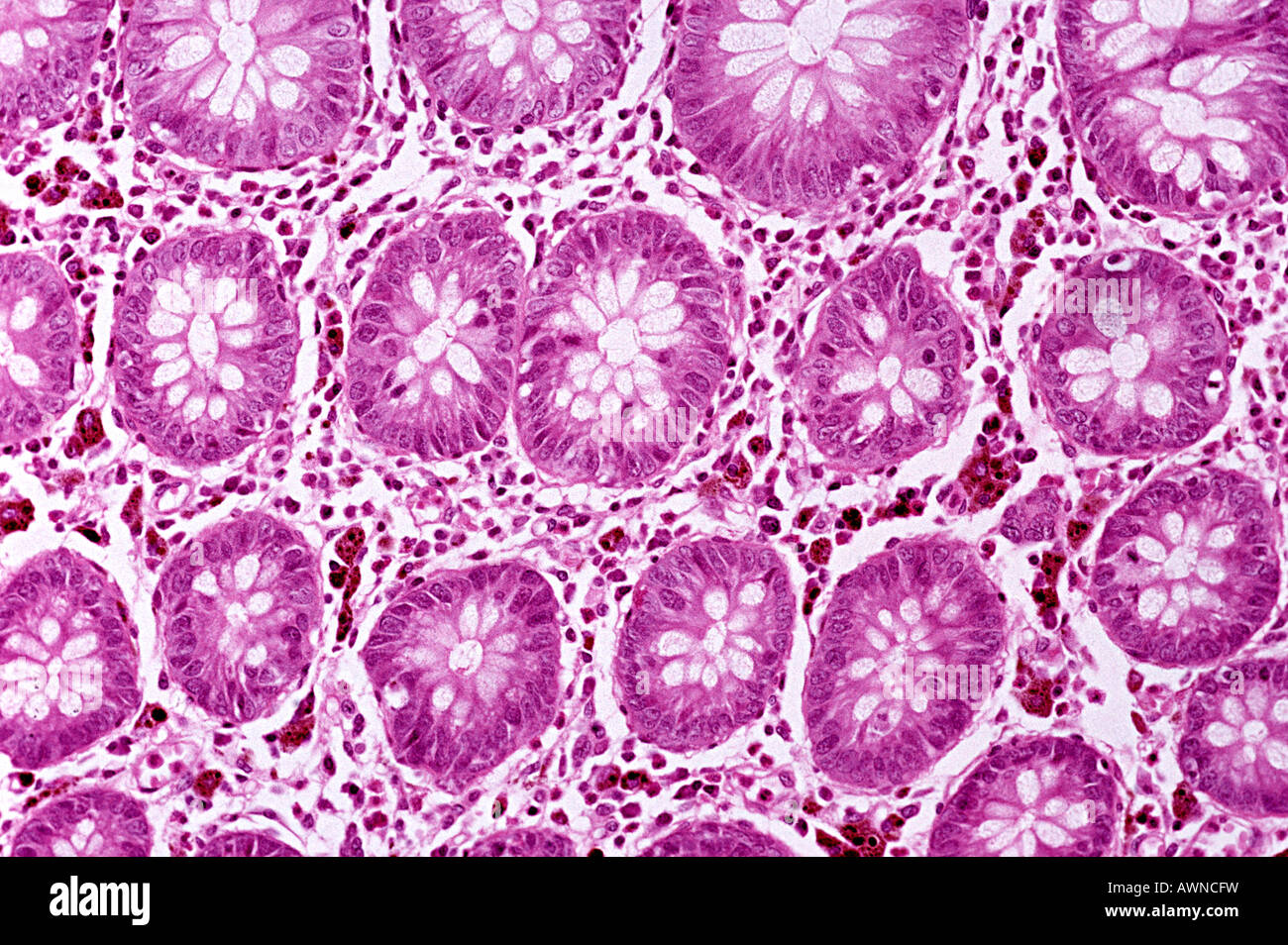 Histology colon hi-res stock photography and images - Alamy