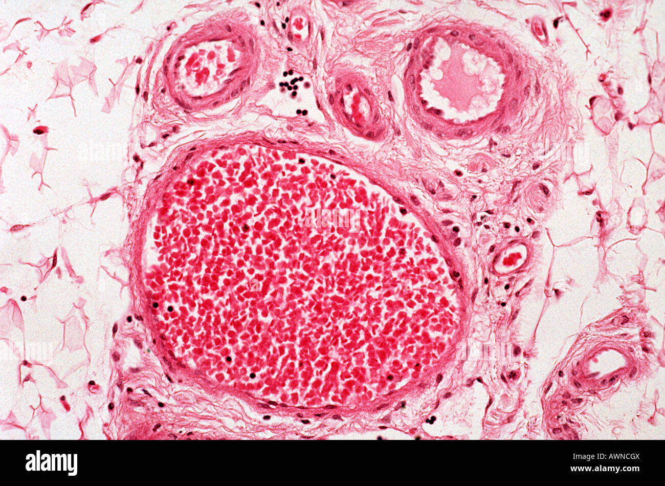 Blood vessel micrograph hi-res stock photography and images - Alamy