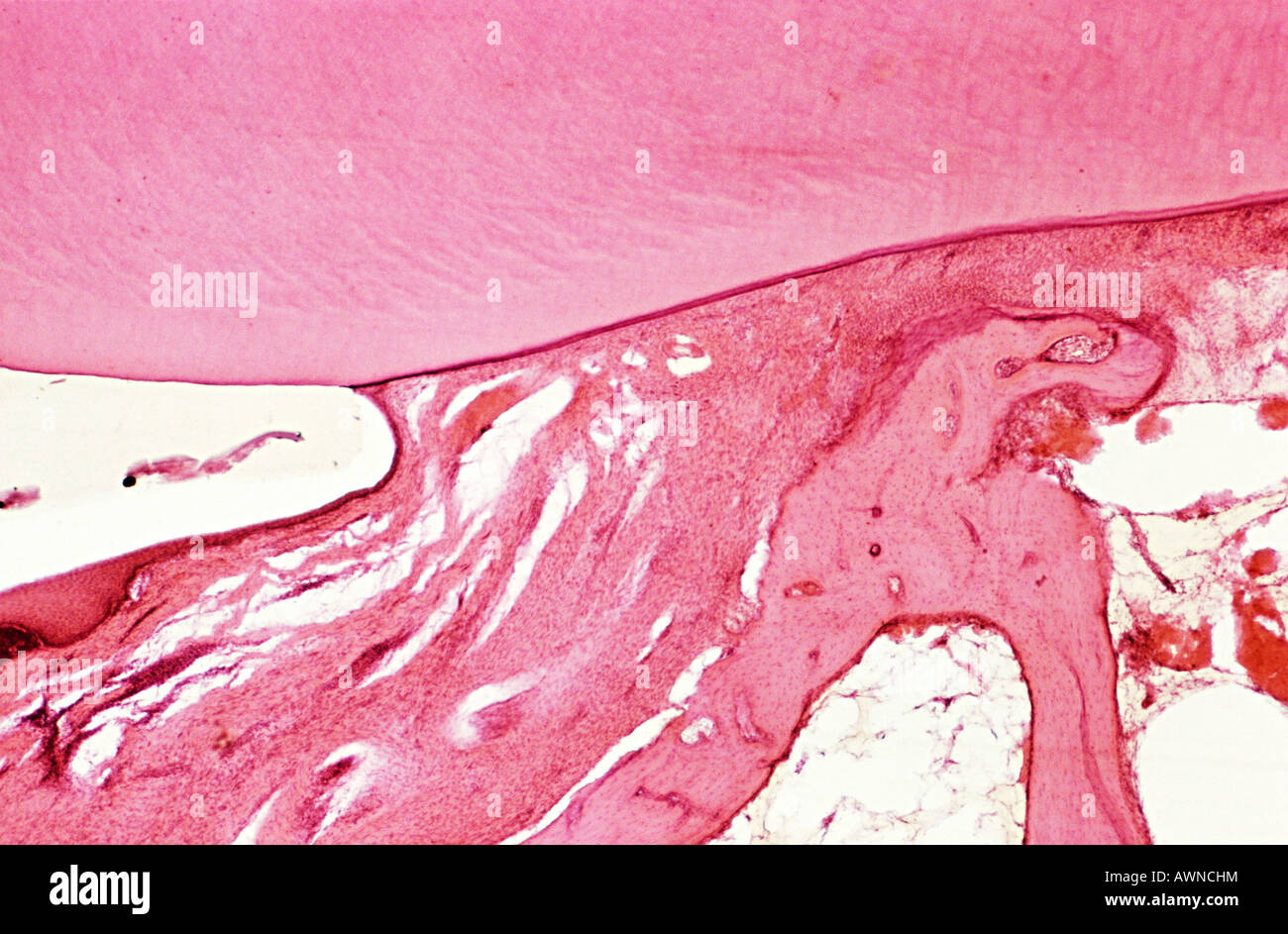 Microscopic teeth hi-res stock photography and images - Alamy