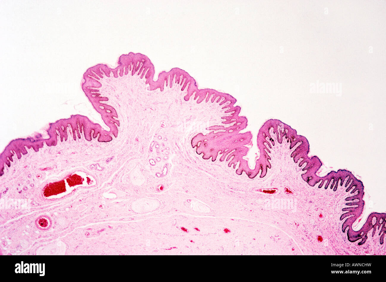 Labium Minus Stock Photo Alamy labium-minus-stock-photo-alamy