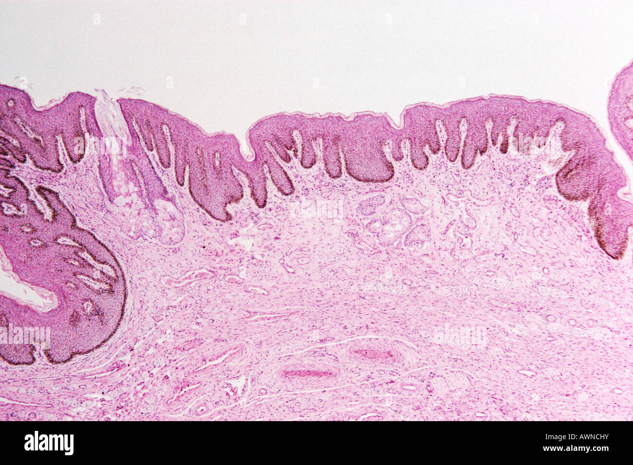 Labium minus hi-res stock photography and images - Alamy