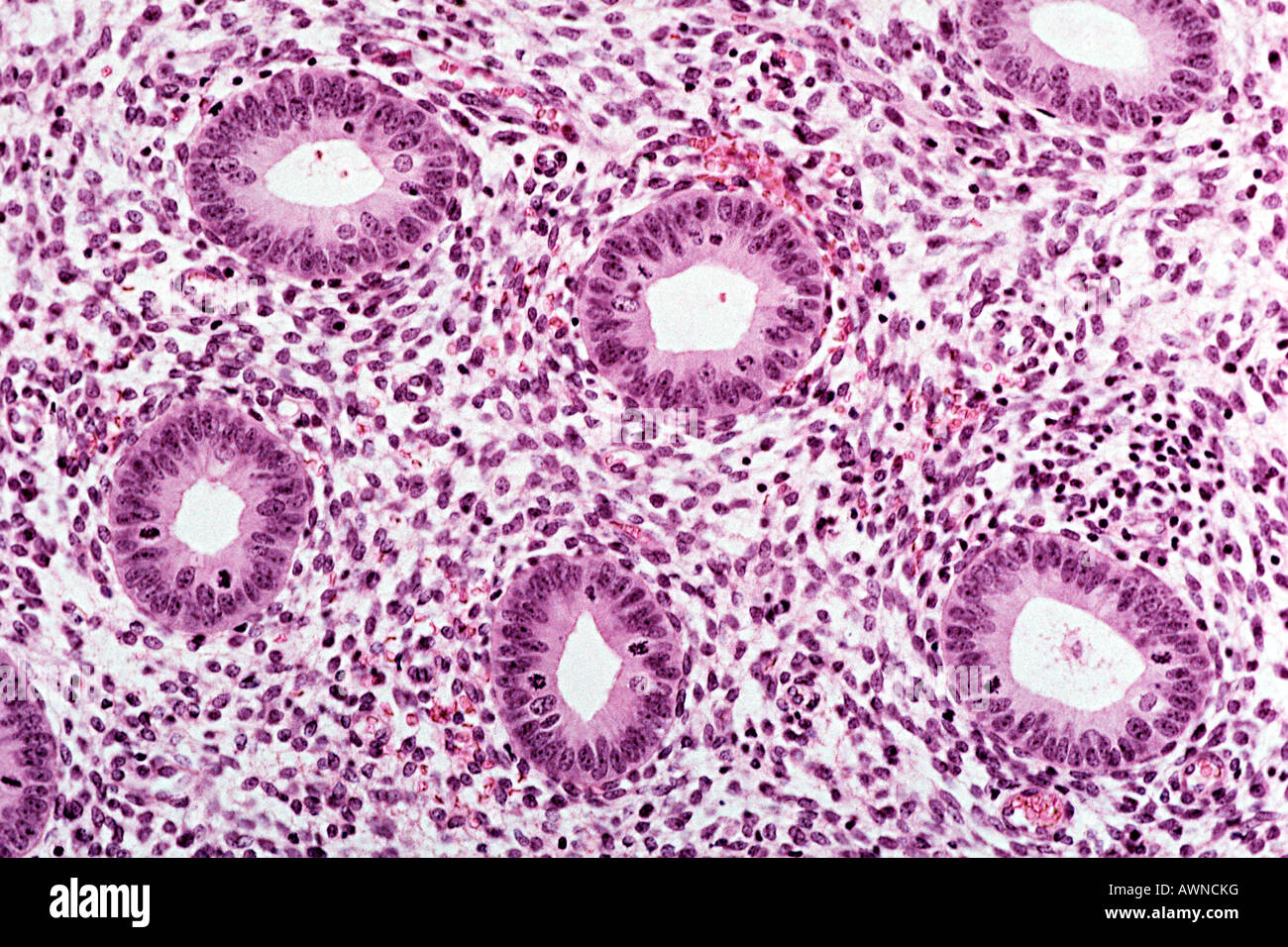 Endometrium High Resolution Stock Photography and Images - Alamy