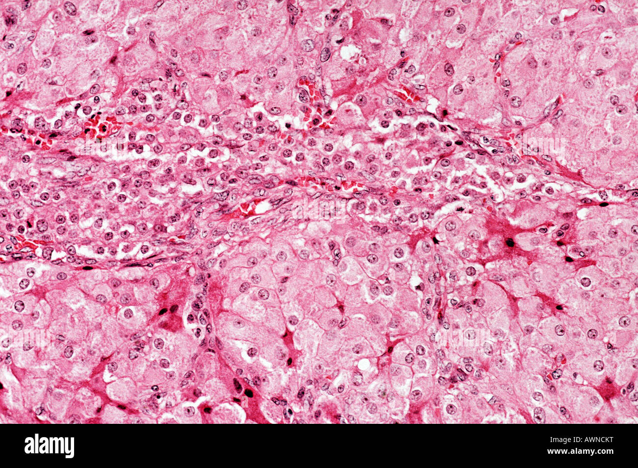 Ovary anatomy hi-res stock photography and images - Alamy