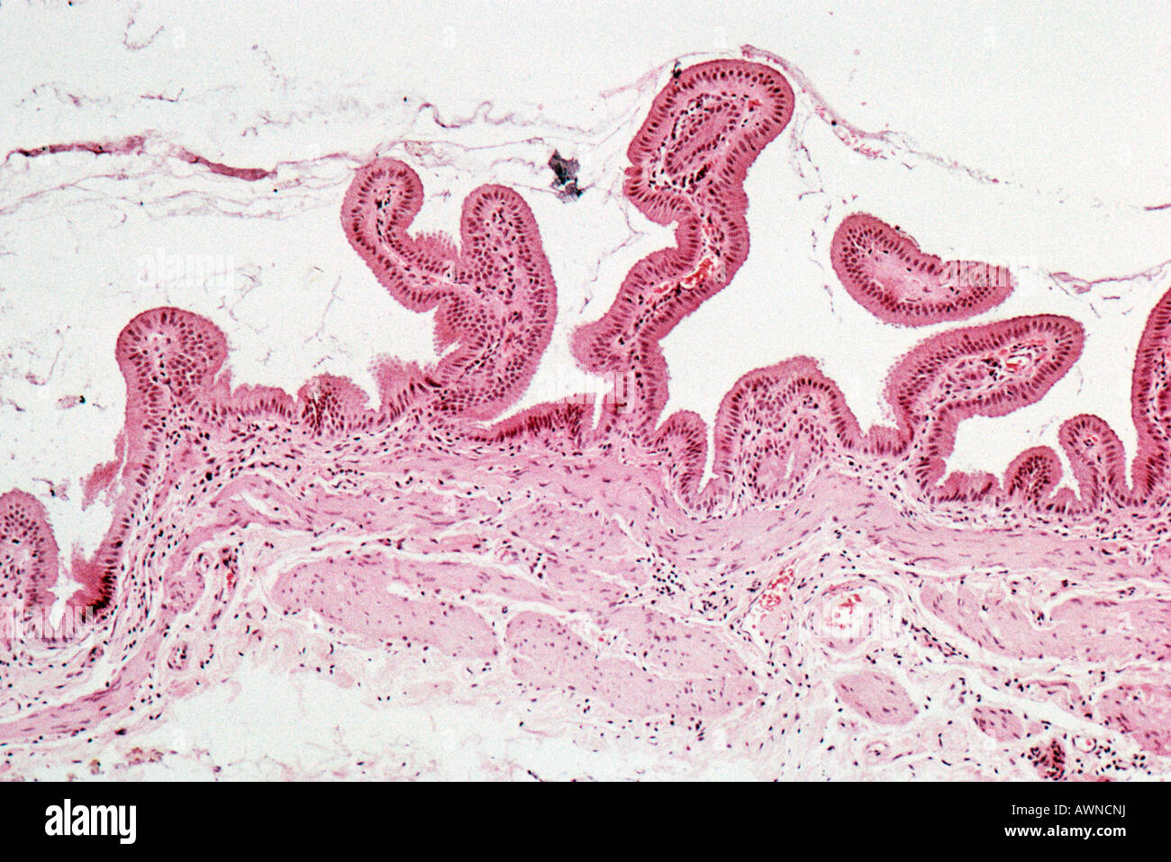 Histology bone marrow hi-res stock photography and images - Alamy