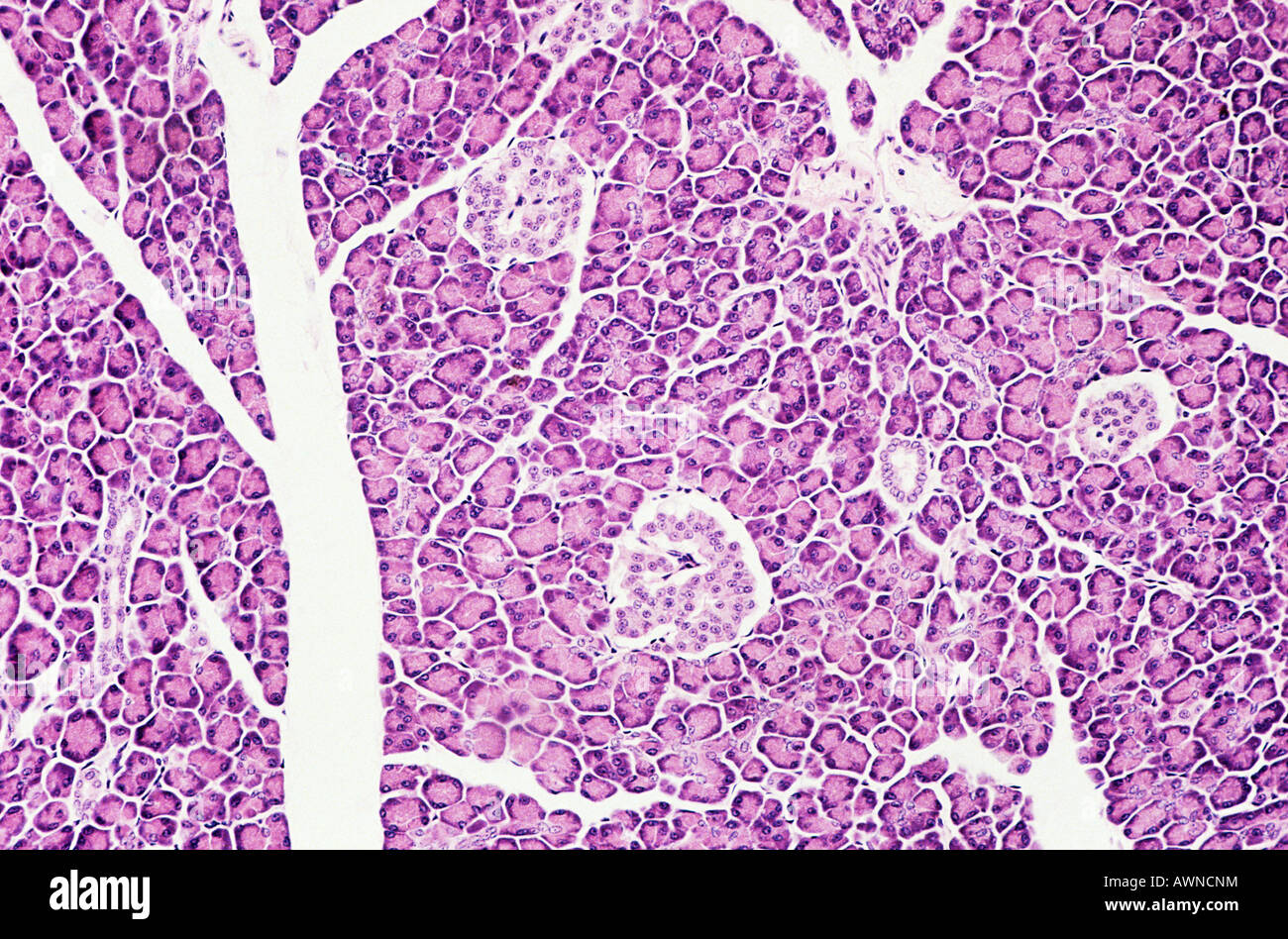 Human pancreas hi-res stock photography and images - Alamy