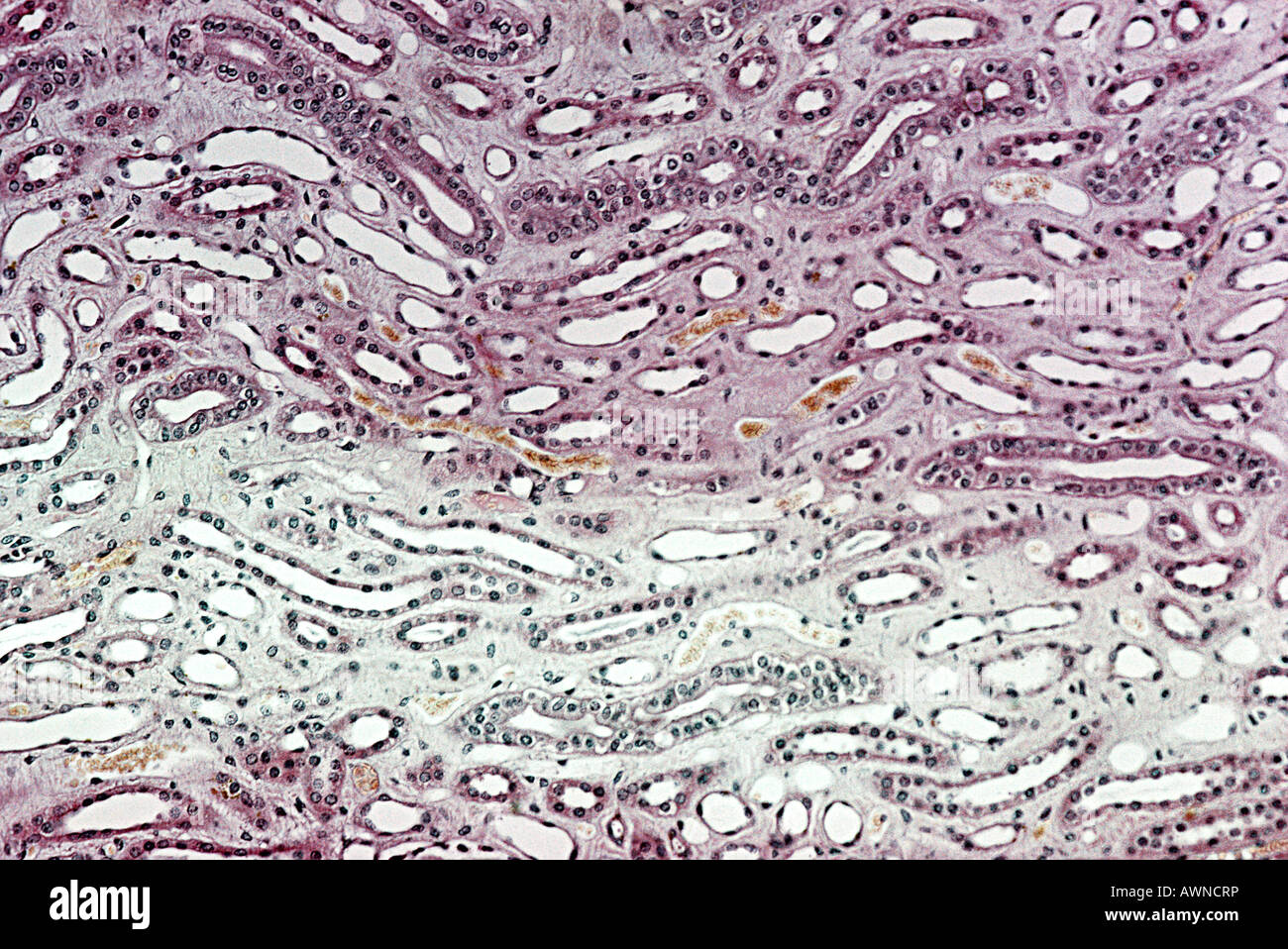 Human kidney cell hi-res stock photography and images - Alamy