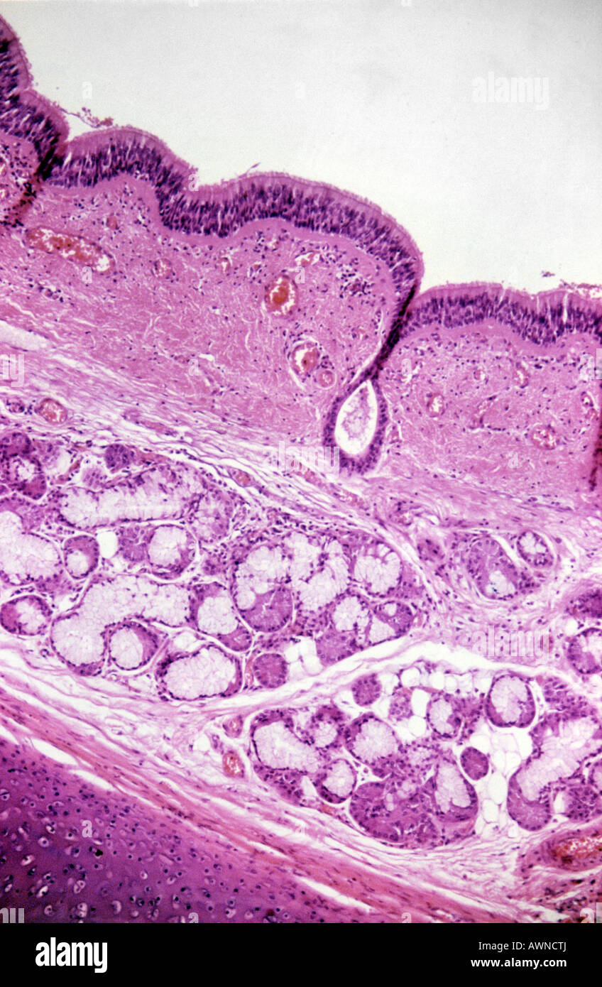 Bronchus anatomy hi-res stock photography and images - Alamy