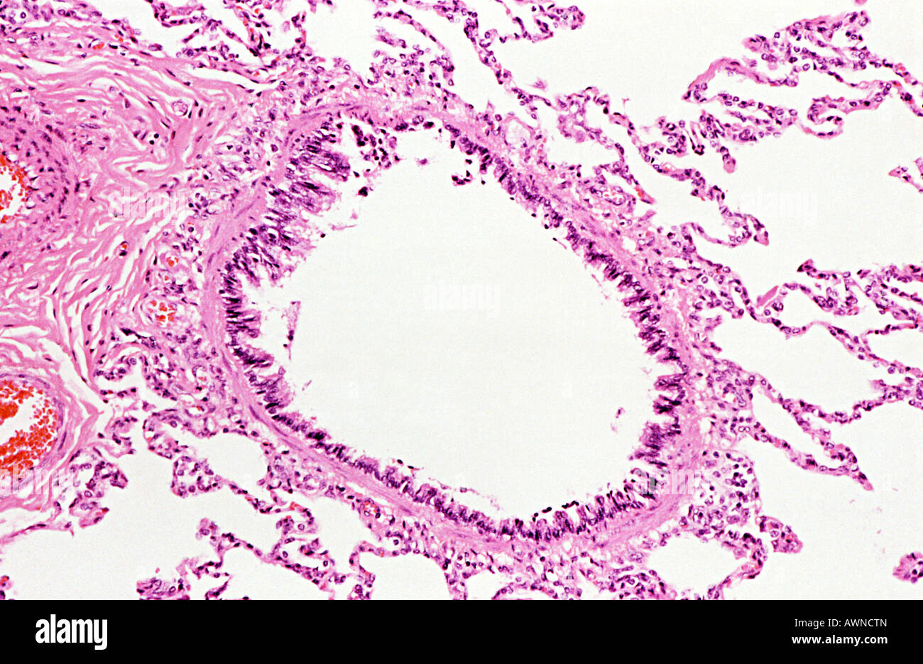 Bronchiole Histology