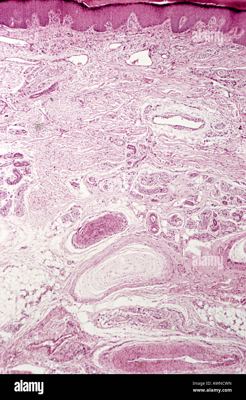 Skin histology hi-res stock photography and images - Alamy
