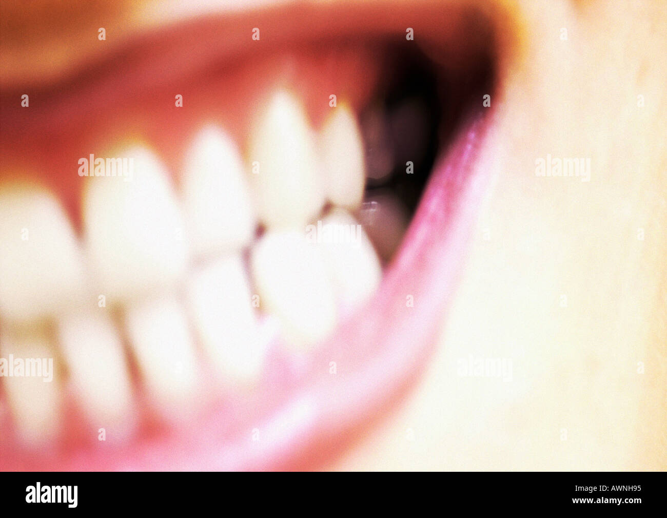 Extreme close-up of woman's mouth, wide open, showing teeth, partial ...