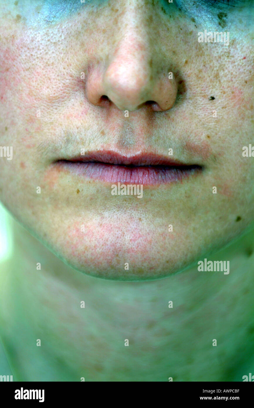 Deathly ill hi-res stock photography and images - Alamy