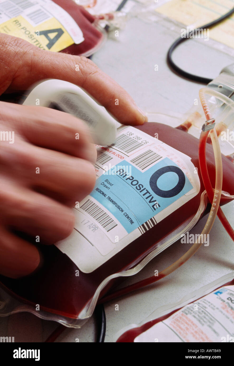 Rh POSITIVE BLOOD FOR TRANSFUSION BEING BARCODE SCANNED Stock Photo - Alamy