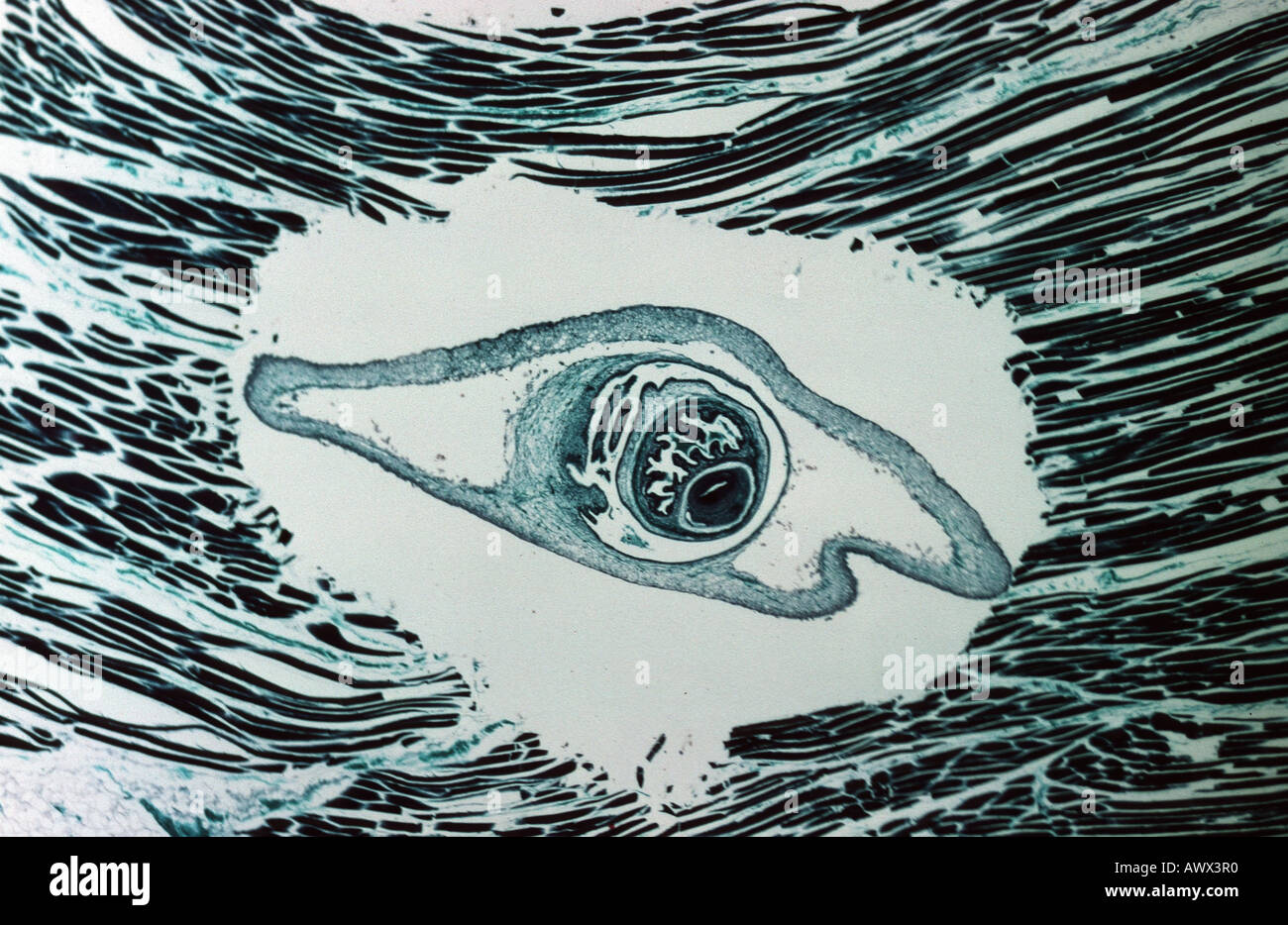 beef tapeworm (Taenia saginata), microscopic cross section of a ...