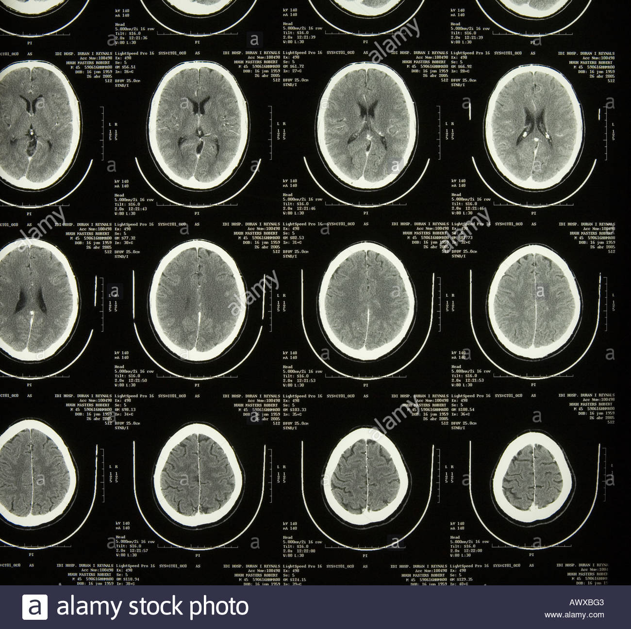 Nmr Brain Scan High Resolution Stock Photography and Images - Alamy