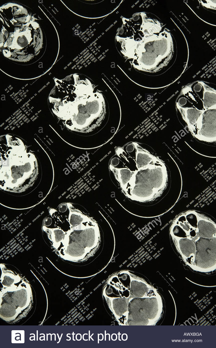 Nmr Brain Scan High Resolution Stock Photography and Images - Alamy