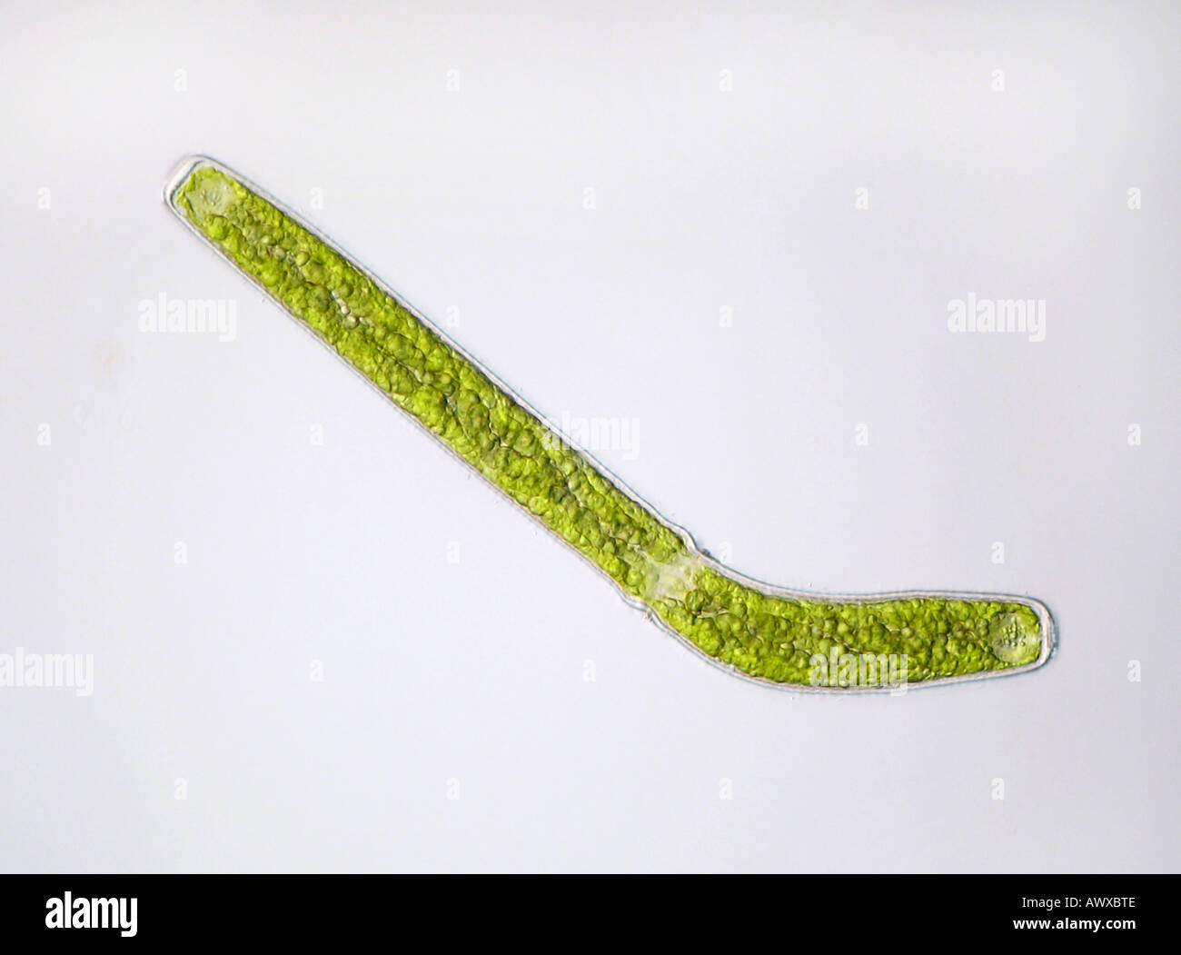 Pleurotaenium trabecula (Pleurotaenium trabecula), growth anomaly, in ...