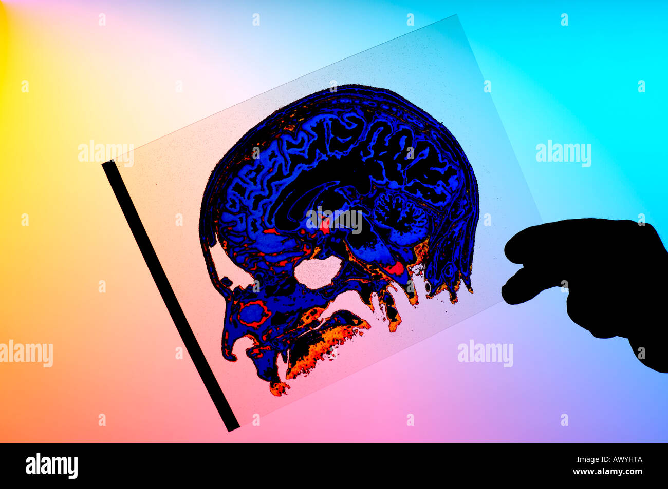 medical technician studying a color transparency of a human skull x-ray ...