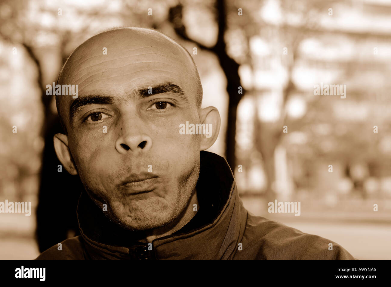 Portrait man swollen face hi-res stock photography and images - Alamy