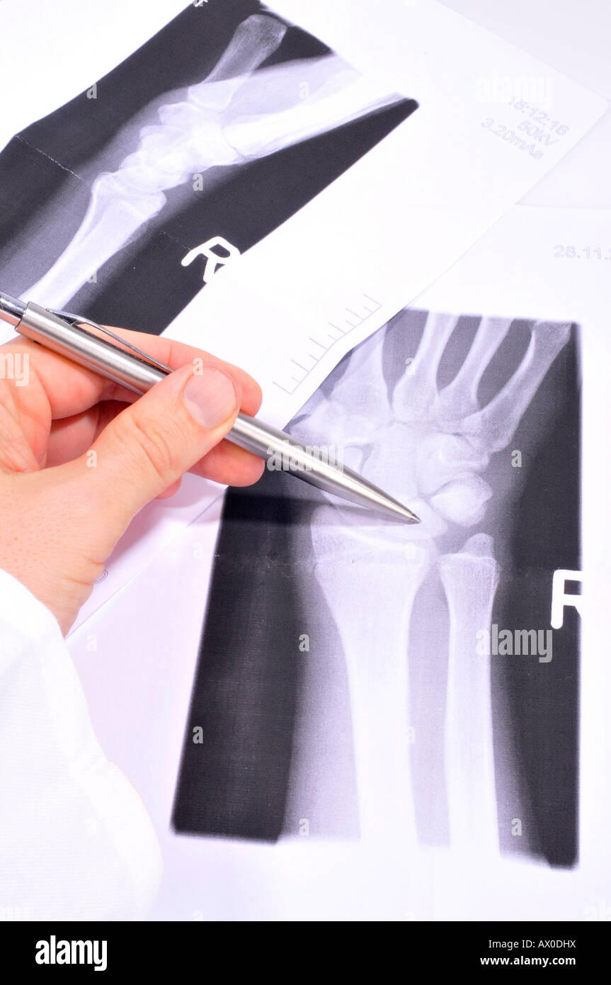 Doctor analyzing an X-ray radiograph Stock Photo - Alamy