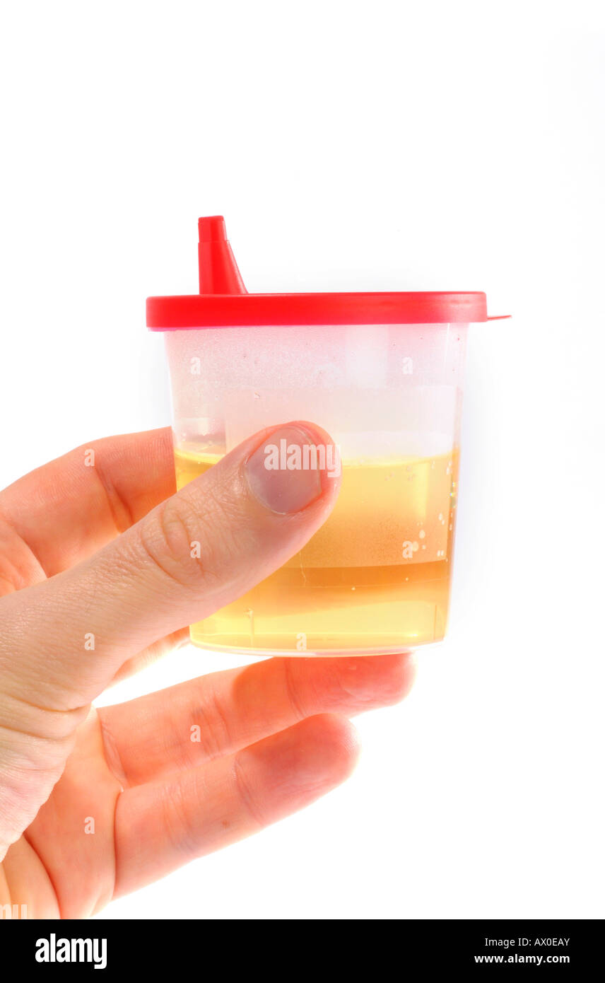 Hand holding filled cup, urine sample, urine test Stock Photo - Alamy