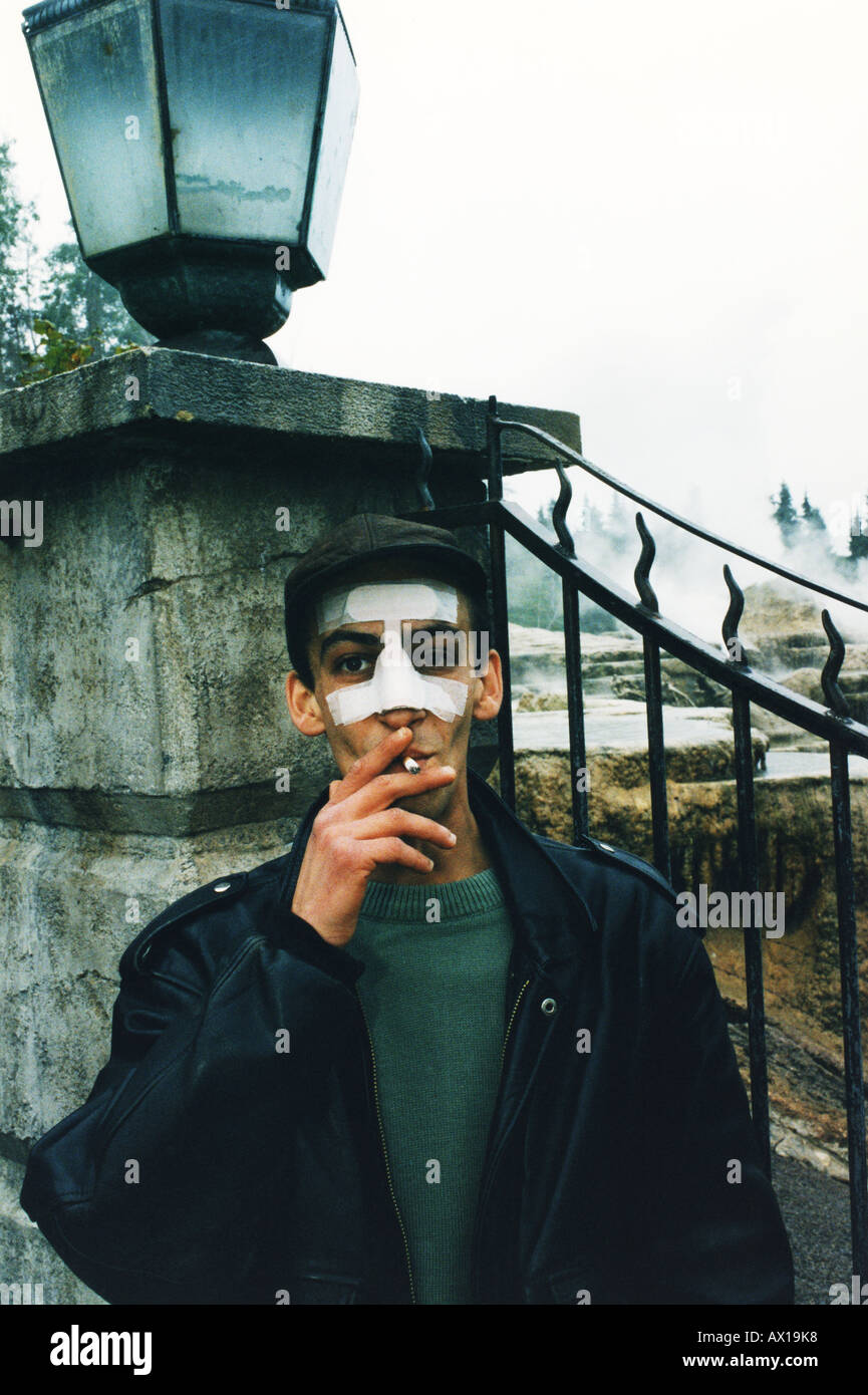 Plaster of paris bandage hi-res stock photography and images - Alamy