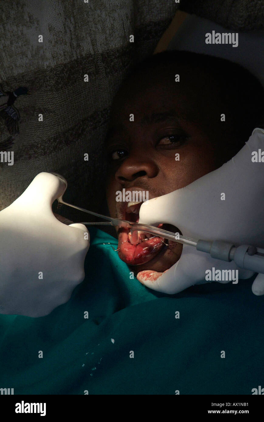 Tooth fingers dentist hi-res stock photography and images - Alamy