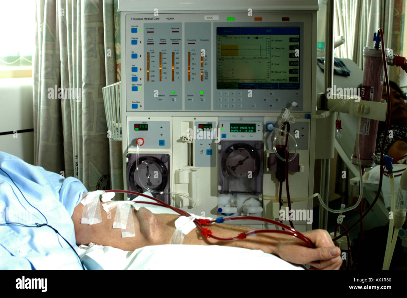 Patient on dialysis machine hi-res stock photography and images - Alamy