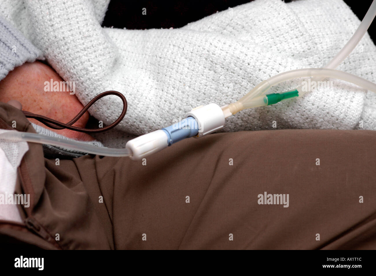 Capd hi-res stock photography and images - Alamy