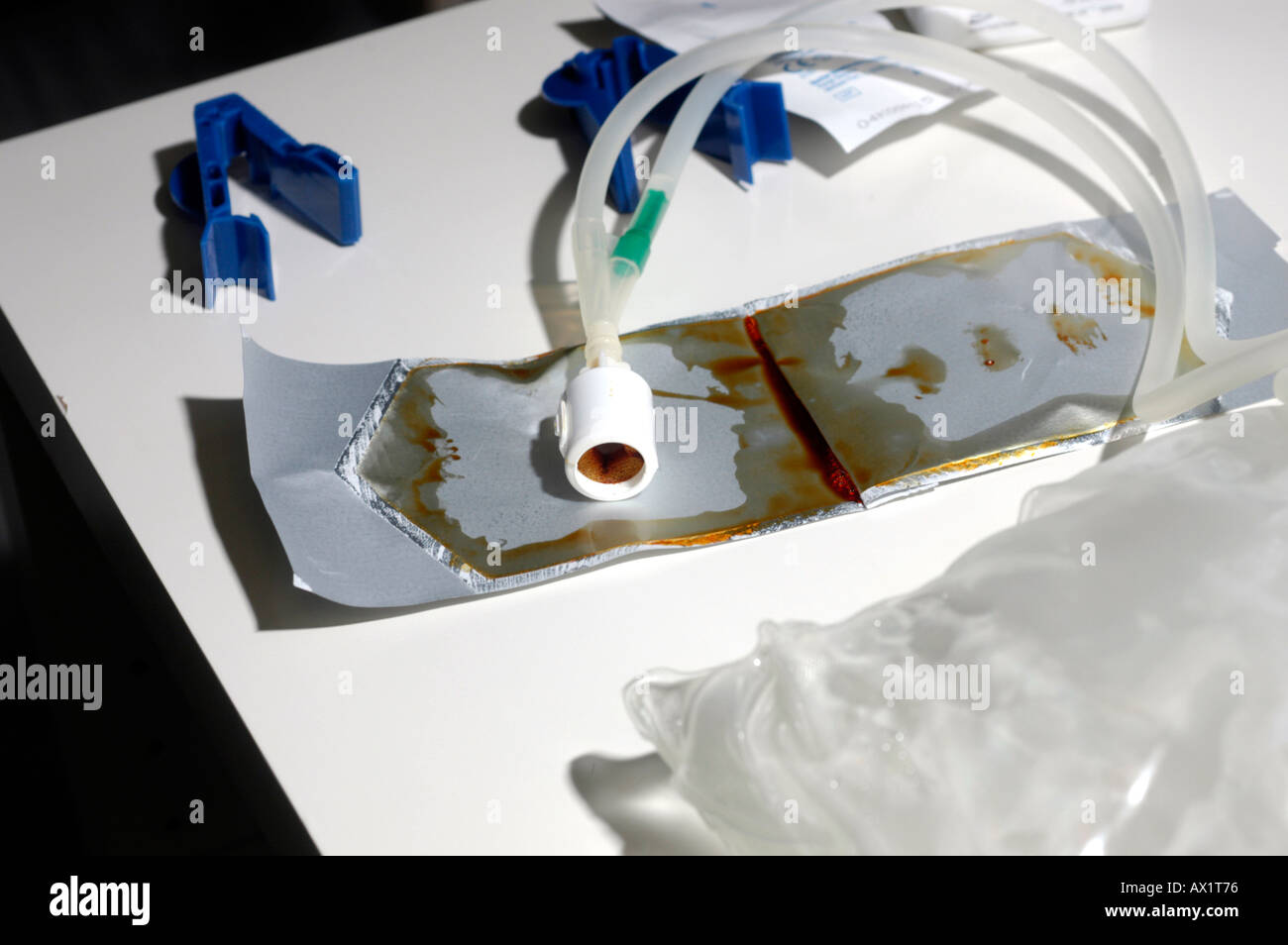 Dialysate bag hi-res stock photography and images - Alamy