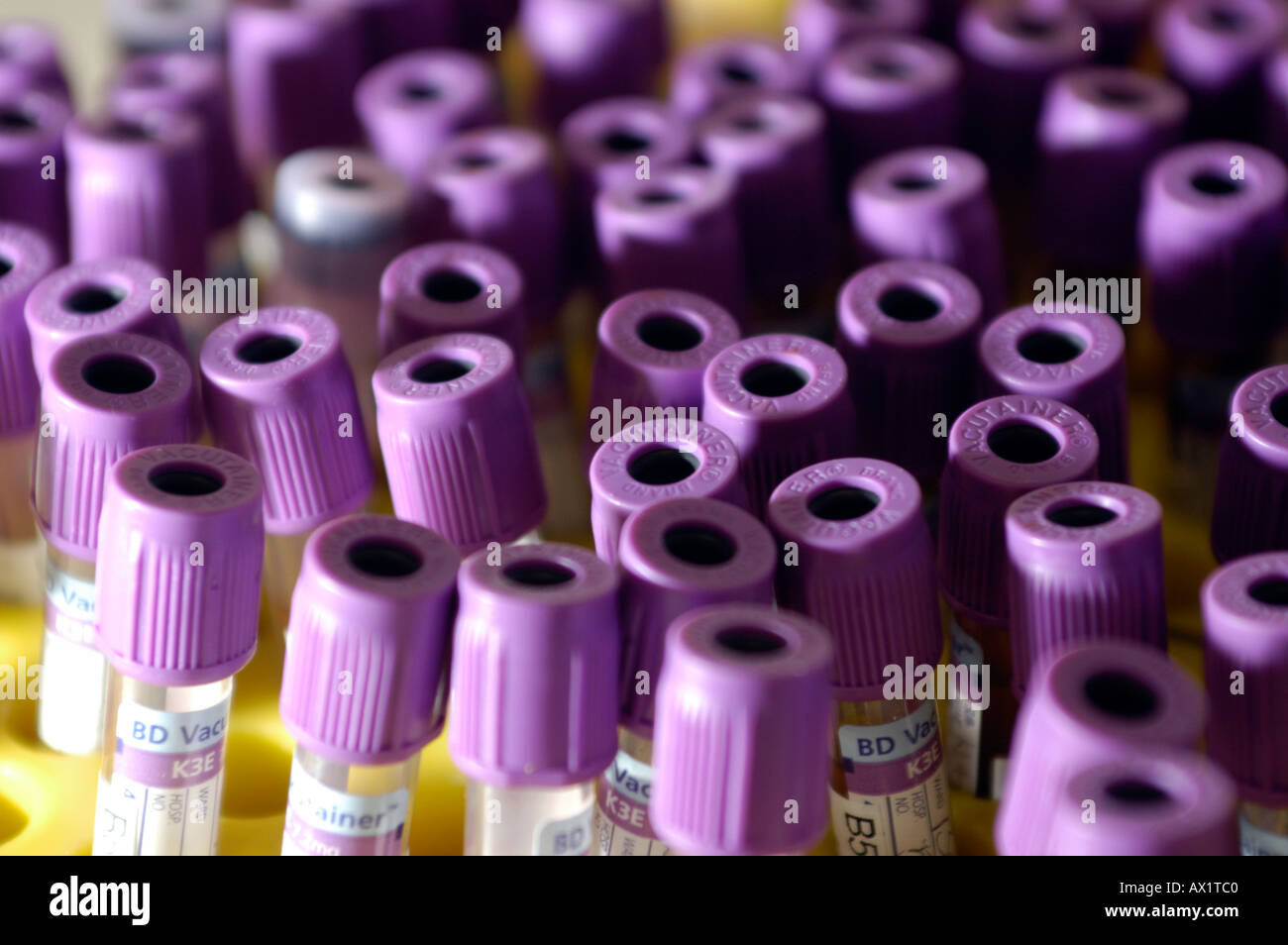 Edta tube hi-res stock photography and images - Alamy