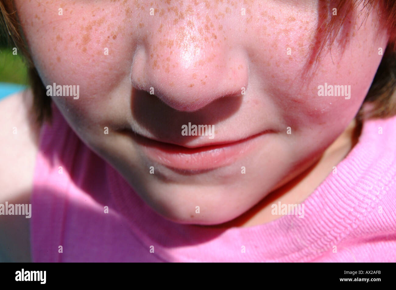 A young girl with freckles mouth and nose Stock Photo - Alamy