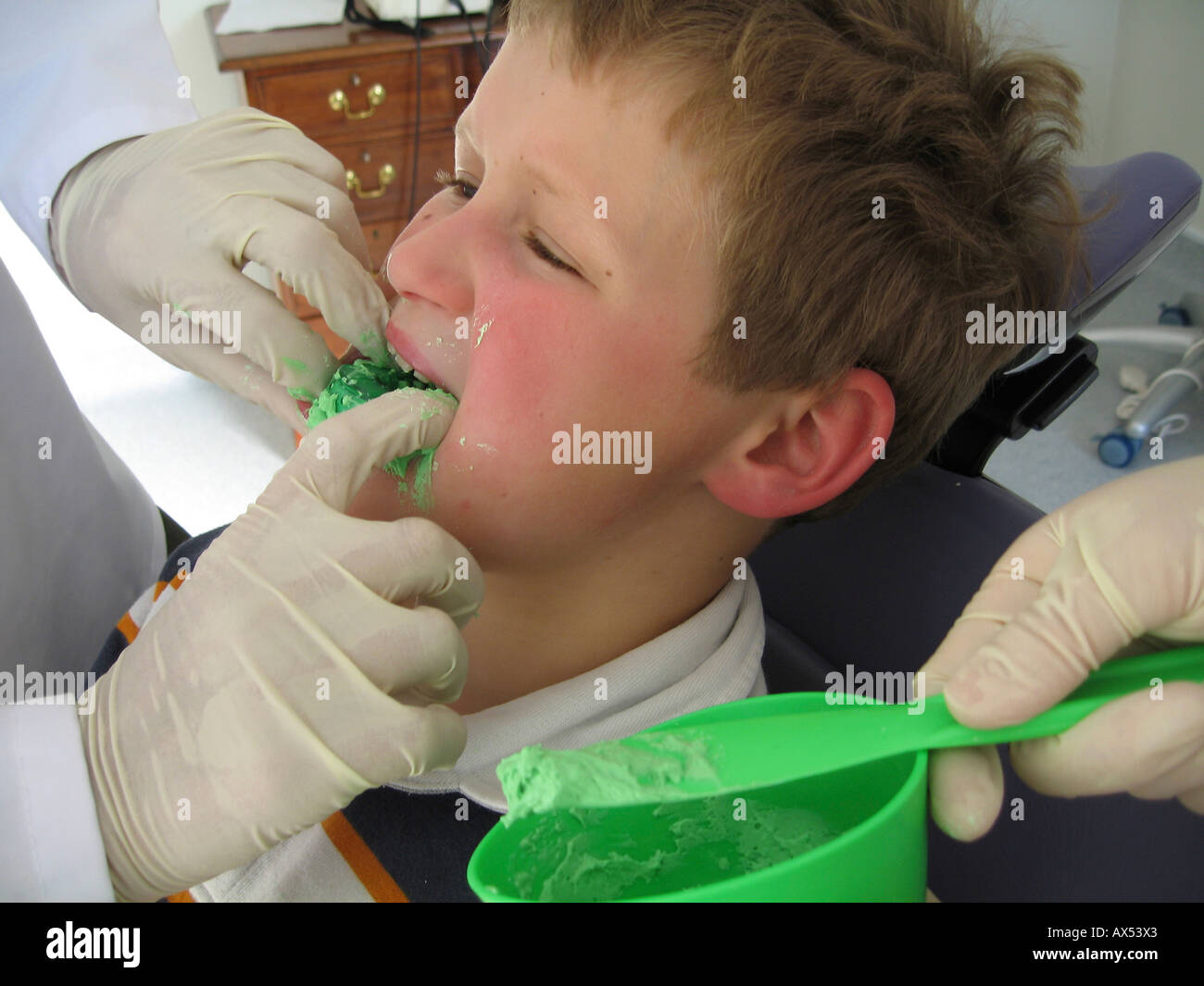 Gum shields hi-res stock photography and images - Alamy