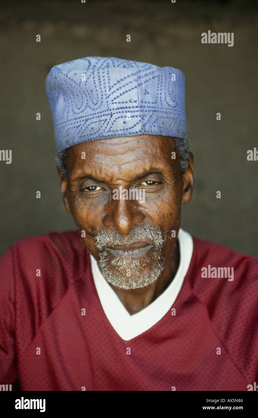 Rheumy eyes hi-res stock photography and images - Alamy